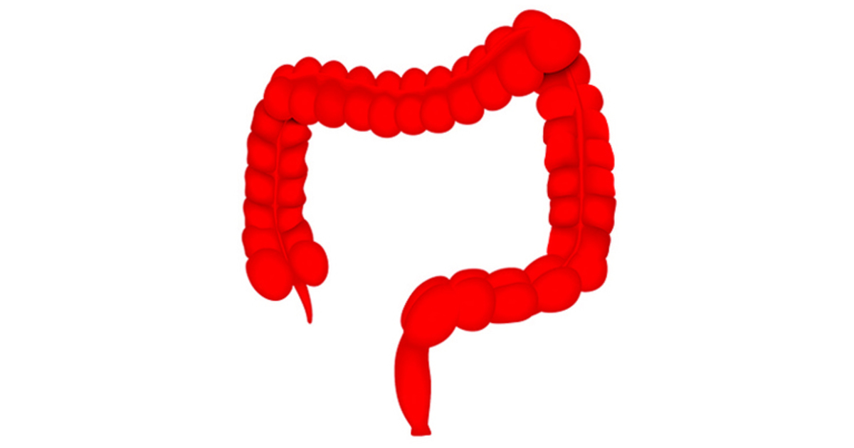 What is Pancolitis | Pancolitis | IBDrelief