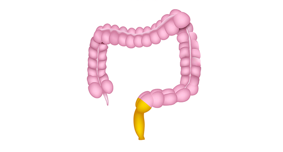 What is ulcerative colitis (UC) | Symptoms | Treatment